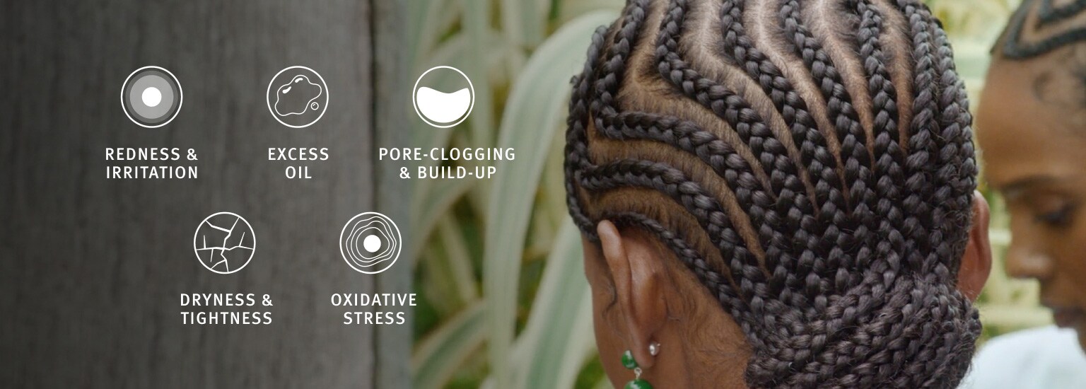 Scalp Solutions Hair Treatments for Dry Scalp | Aveda